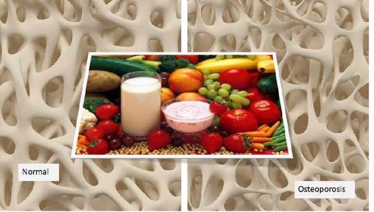 How to boost your bone health according to your age group?