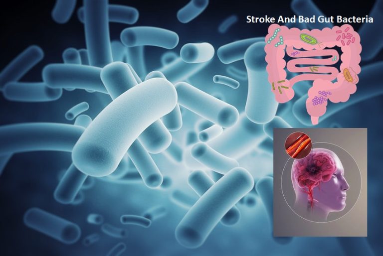 New study links gut microbiota strains with more severe strokes and ...